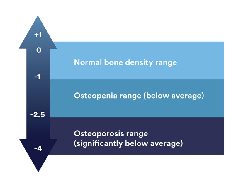 Osteoporosis — Treatment, Symptoms, & Bone Health